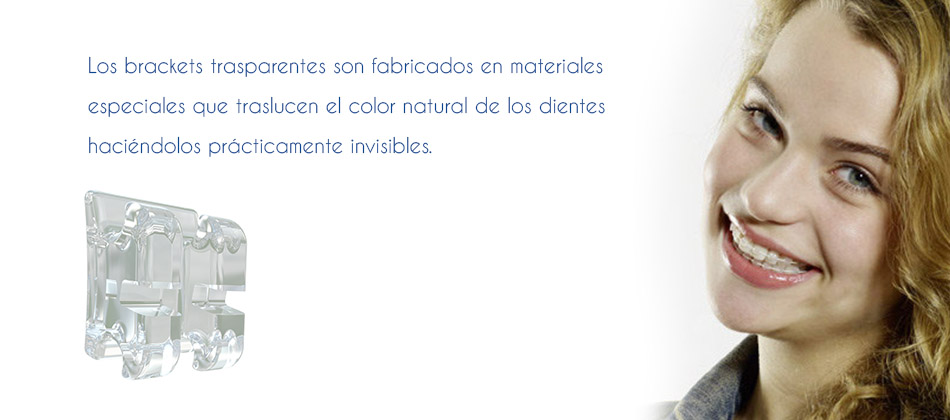 Ortodoncia Lingual Medellí­n: Braquets transparentes